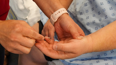 "Upper Extremities Sensory Exam: Pin hand" by Clinical Neurological ...