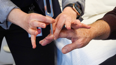 "Sensory exam: testing vibration hand" by Clinical Neurological ...