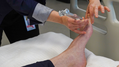 "Sensory exam: testing vibration toe" by Clinical Neurological Sciences ...